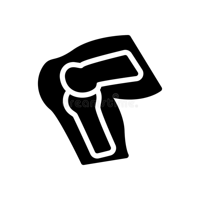 Rodilla ilustración del vector. Ilustración de ortopédico - 217666491