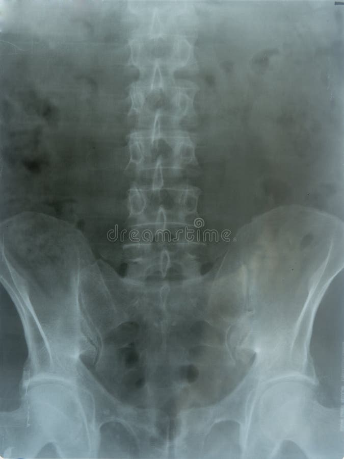 186 Pelvic Man Pain Stock Photos - Free & Royalty-Free Stock Photos ...