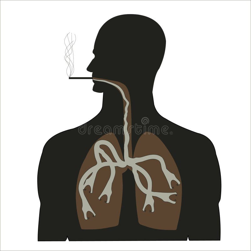 Roken is Schadelijk Voor Gezondheid Vector Illustratie - Illustration ...