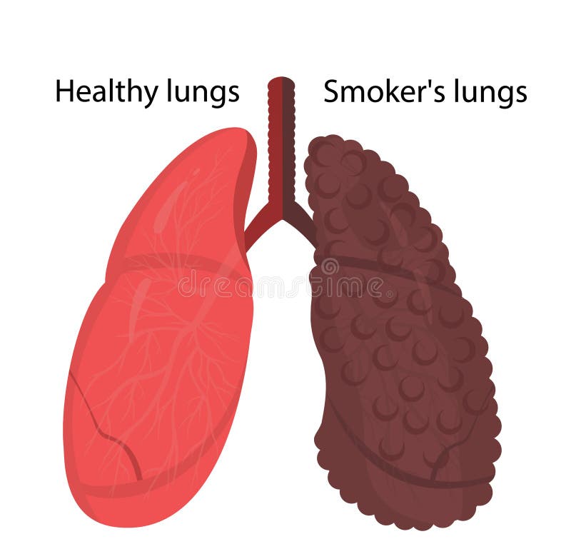 De Vectorillustratie Van Rokerslongen Vector Illustratie - Illustratie ...