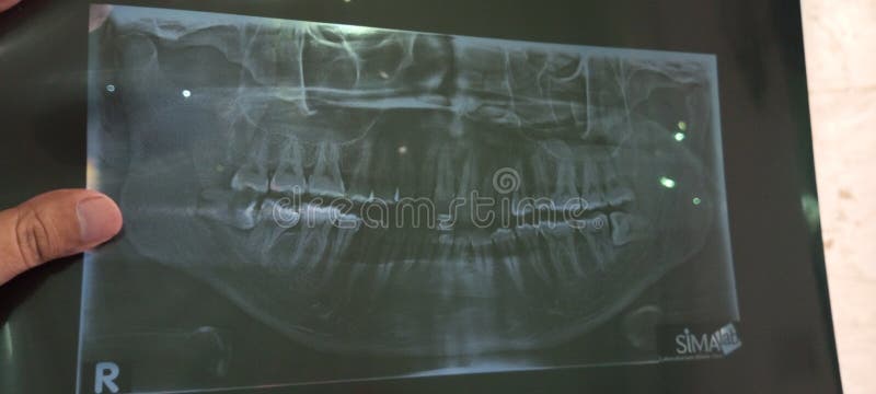 Rongent Stock Photos - Free & Royalty-Free Stock Photos from Dreamstime