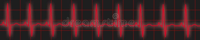Electrocardiogram of Resultaat ECG Van Een Test Van De Spanning Van De ...