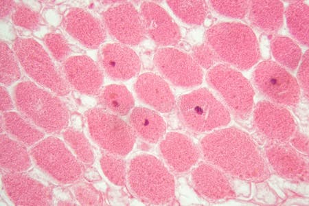 Root Bacteria Nodules Under the Microscope. Stock Photo - Image of ...