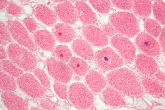 Root Bacteria Nodules Under the Microscope. Stock Photo - Image of ...