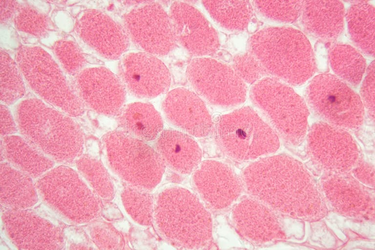 Root Bacteria Nodules Under the Microscope. Stock Photo - Image of ...