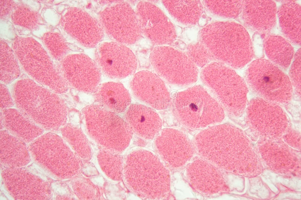 Root Bacteria Nodules Under the Microscope. Stock Photo - Image of ...