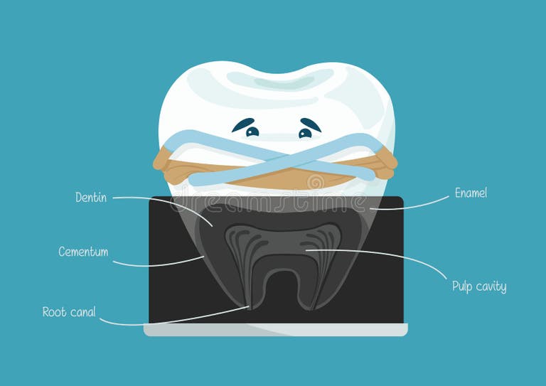 Root Canal Cartoon Stock Illustrations – 413 Root Canal Cartoon Stock ...
