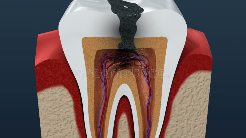 Dental Root Anatomy - First Maxillary Molar Tooth. Medically Accurate ...