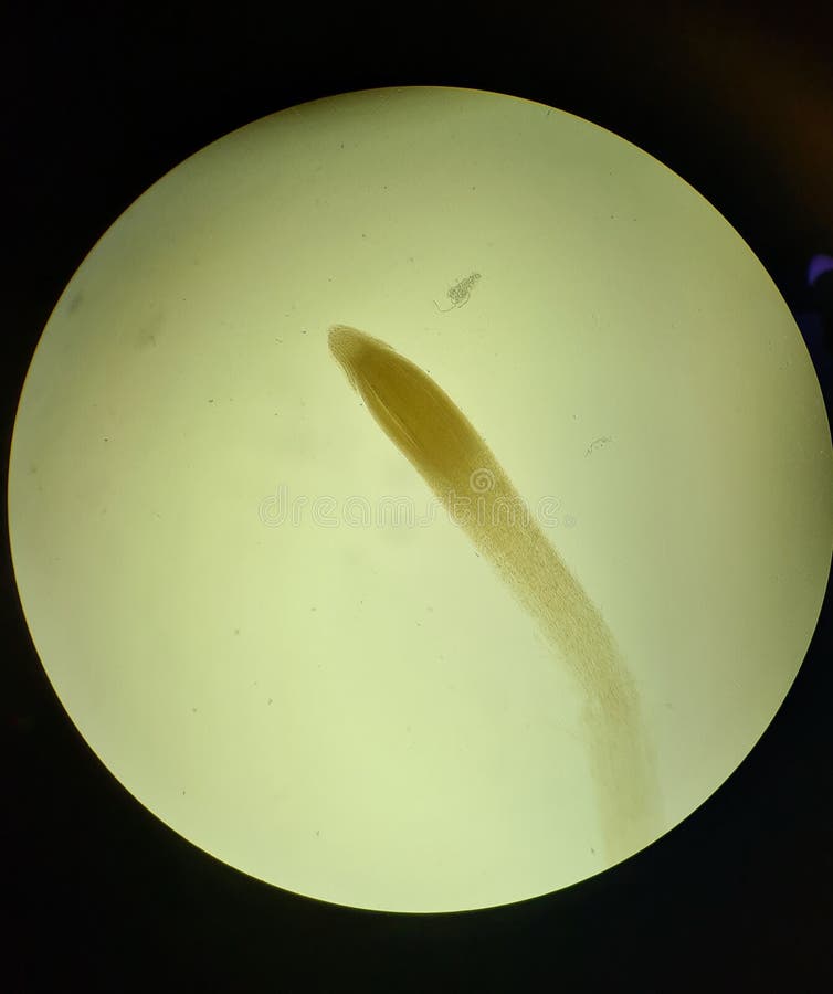 Root Cap in the Field of View of the Microscope Stock Image - Image of ...