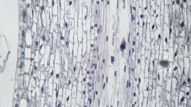 Root Tip of Allium Cepa in Longitudinal Section Magnified by Microscope ...