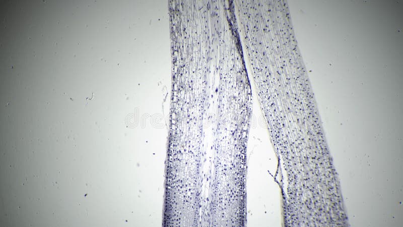 Root Tip of Allium Cepa in Longitudinal Section Magnified by Microscope ...