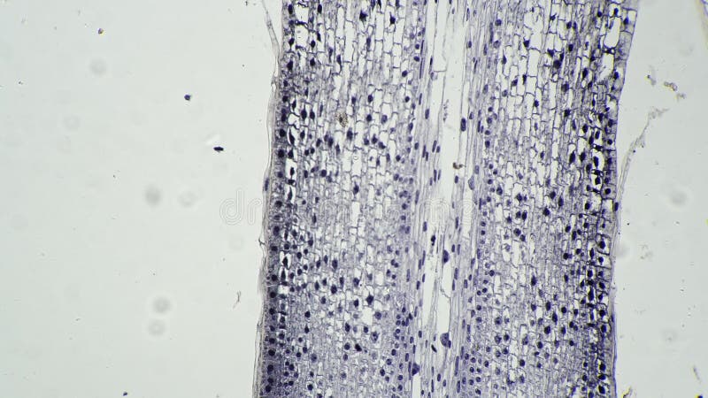Root Tip of Allium Cepa in Longitudinal Section Magnified by Microscope ...