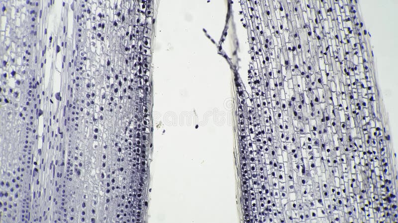 Root Tip of Allium Cepa in Longitudinal Section Magnified by Microscope ...