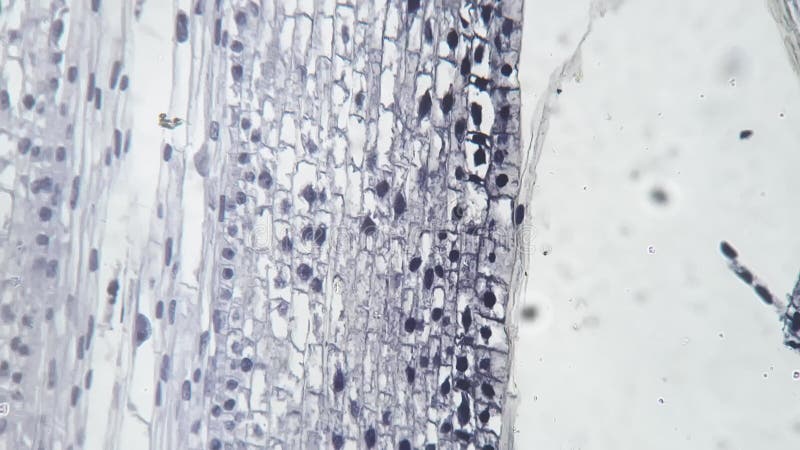 Root Tip of Allium Cepa in Longitudinal Section Magnified by Microscope ...