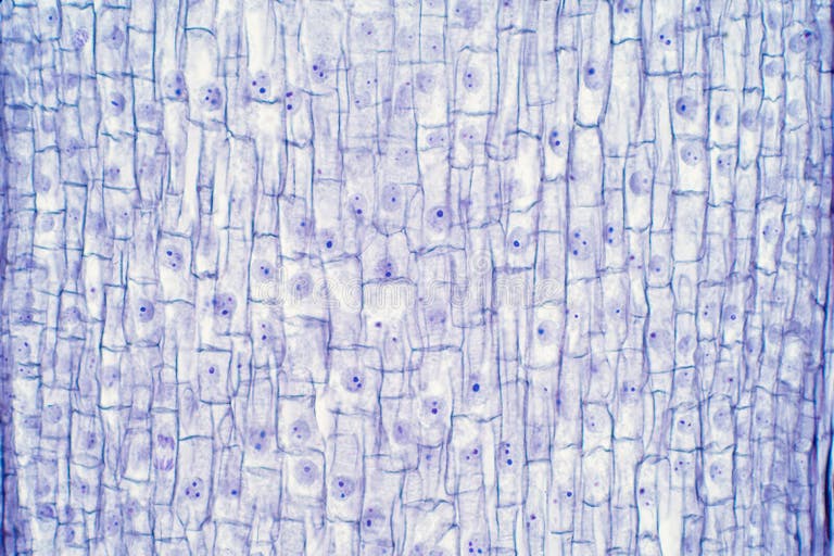 Root Tip of Onion and Mitosis Cell in the Root Tip Stock Photo - Image ...