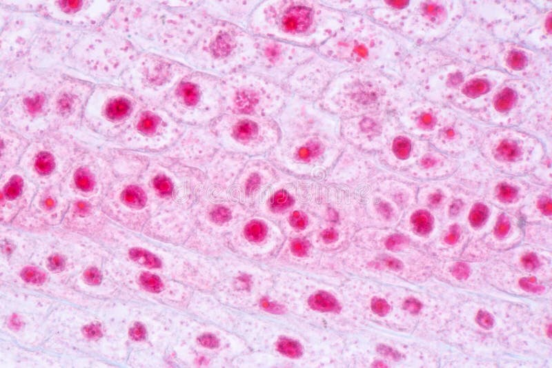 Mitosis Cell In The Root Tip Of Onion Under A Microscope. Stock Image ...
