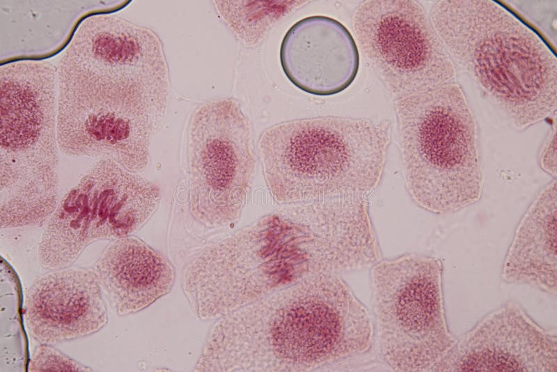 Interphase Microscope