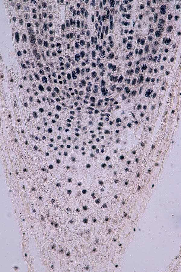 Root Tip of Onion and Mitosis Cell in the Root Tip of Onion Under a ...