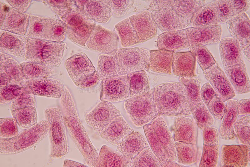 Root Tip of Onion and Mitosis Cell in the Root Tip of Onion Under a ...