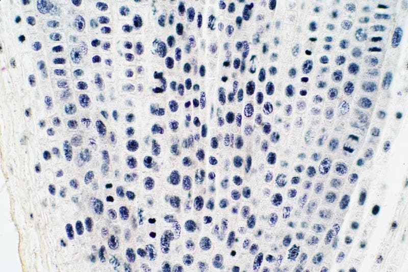 Root Tip of Onion and Mitosis Cell in the Root Tip Stock Image - Image ...