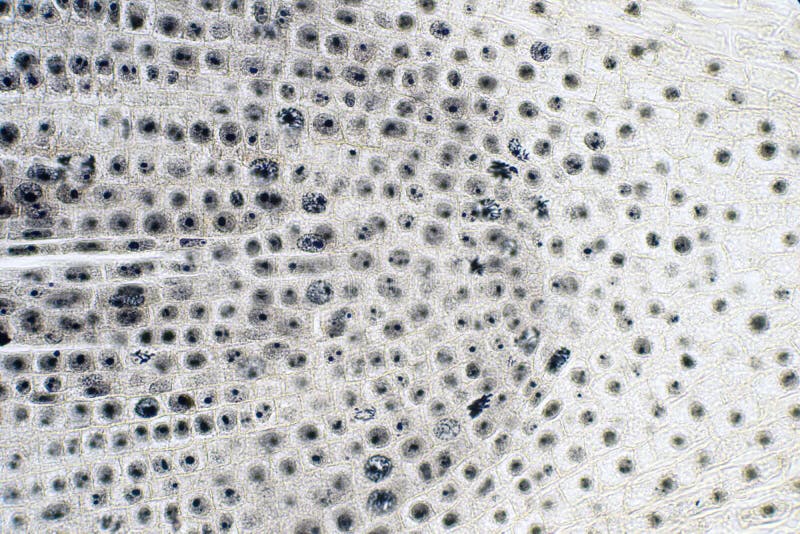 Root Tip of Onion and Mitosis Cell in the Root Tip Stock Photo - Image ...