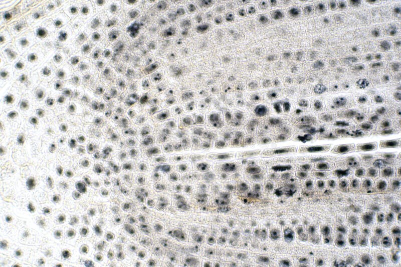 Root Tip of Onion and Mitosis Cell in the Root Tip Stock Photo - Image ...