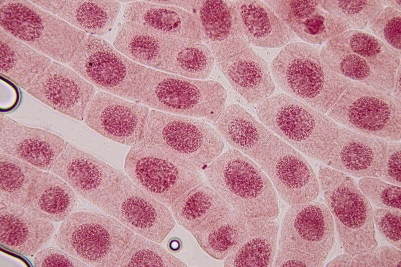 Mitosis Cell in the Root Tip of Onion Under a Microscope. Stock Image ...