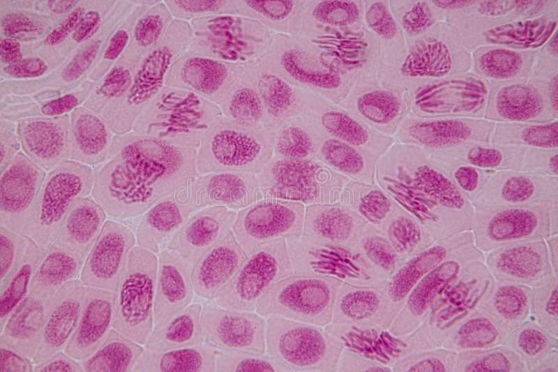 Metaphase Microscope
