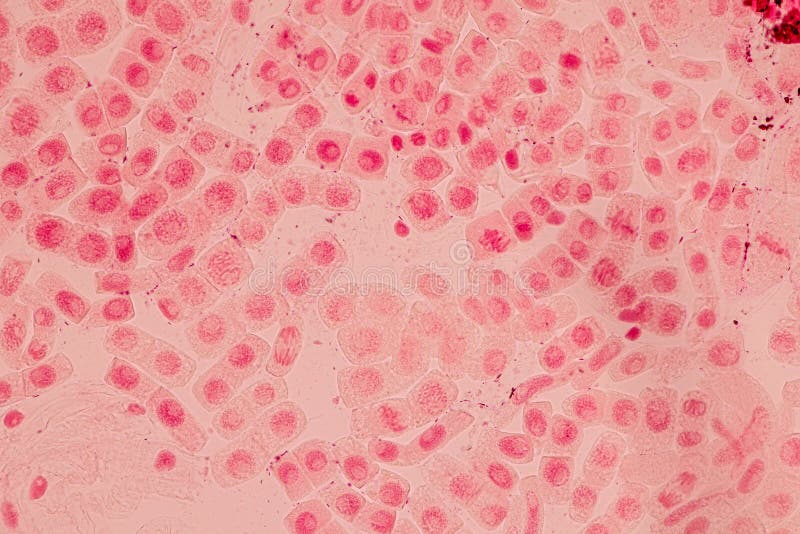 Mitosis Cell in the Root Tip of Onion Under a Microscope. Stock Image ...