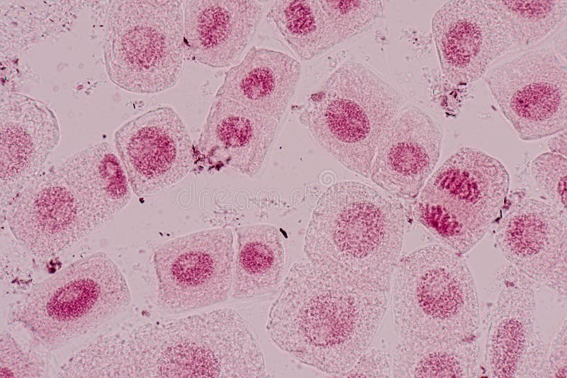 Mitosis Cell in the Root Tip of Onion Under a Microscope. Stock Image ...