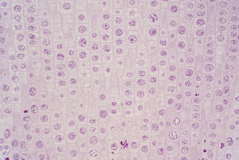 Mitosis Cell in the Root Tip of Onion Under a Microscope. Stock Photo ...