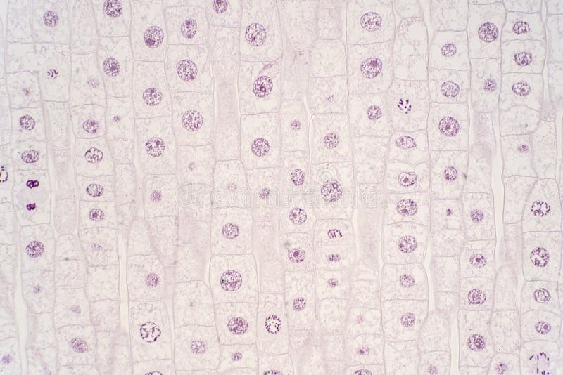 Root Tip of Onion Show Mitosis Cell in the Root Tip Under Microscope ...
