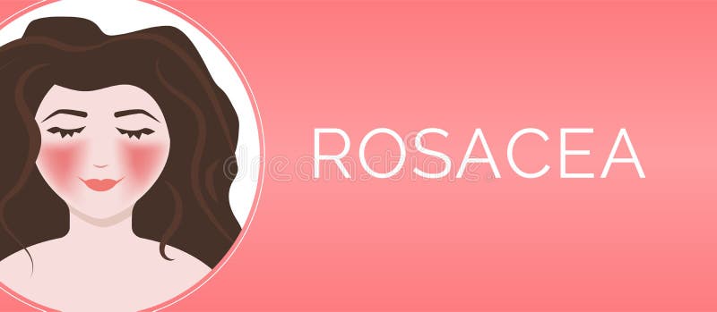 Rosacea Background Banner Illustration Stock Vector - Illustration of ...