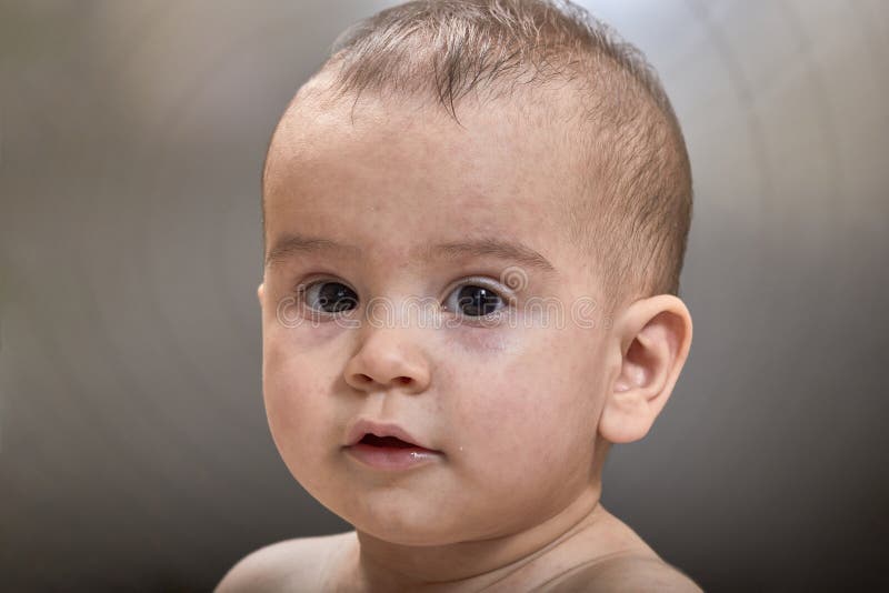 Roseola Rash a Viral Rash on the Skin of a Child Stock Photo - Image of ...
