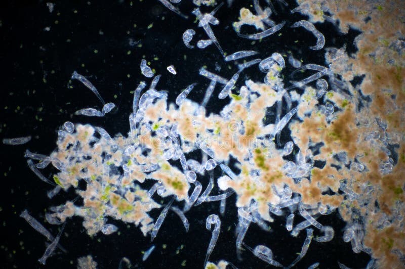 The rotifer stock image. Image of light, contrast, larva - 81531201