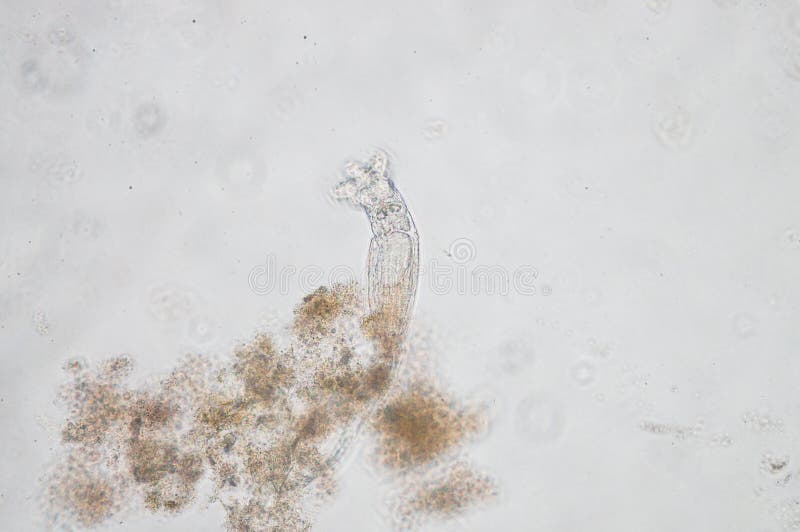 The Rotifer Rotifera, Commonly Called Wheel Animals Under the ...