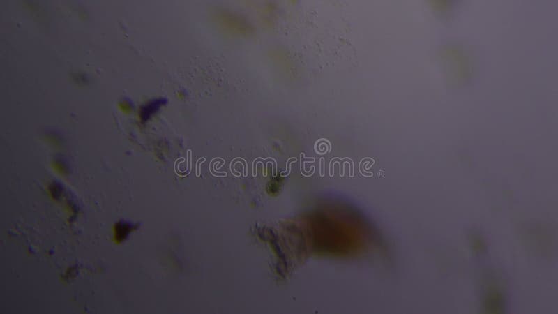 Rotifers or Wheels Under the Microscope | a Microorganism that Lives in ...