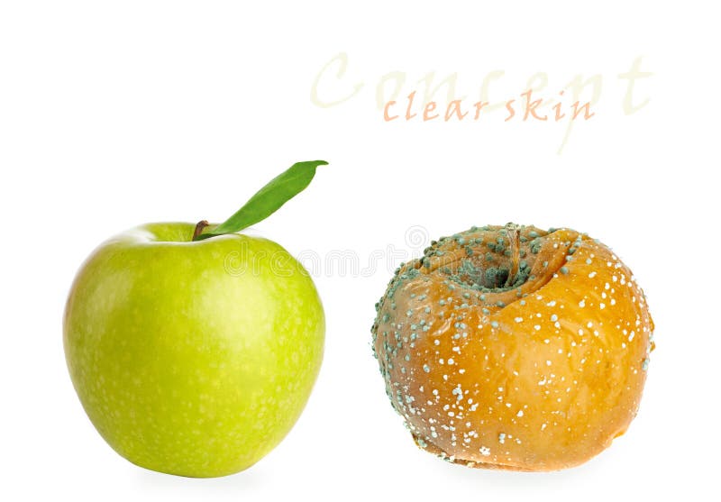 Rotten Apple and Fresh Apple Stock Photo - Image of comparison, pimple ...