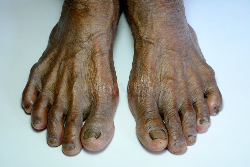 Rough foot stock photo. Image of health, fingers, hand - 55327304