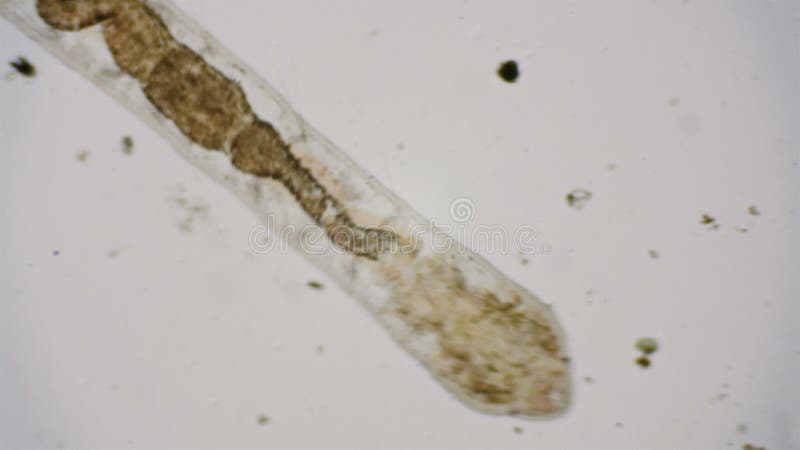 Roundworm Under the Microscope in 4k Stock Video - Video of life ...