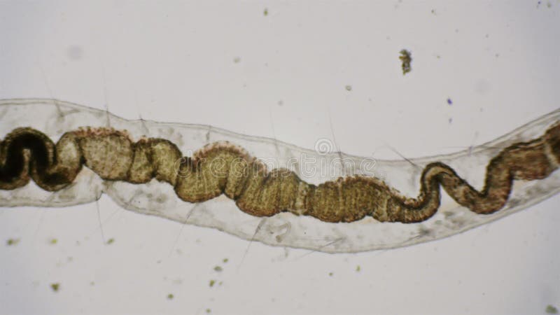 Roundworm Nematode Moves in Fresh Water Under a Microscope Close Up ...