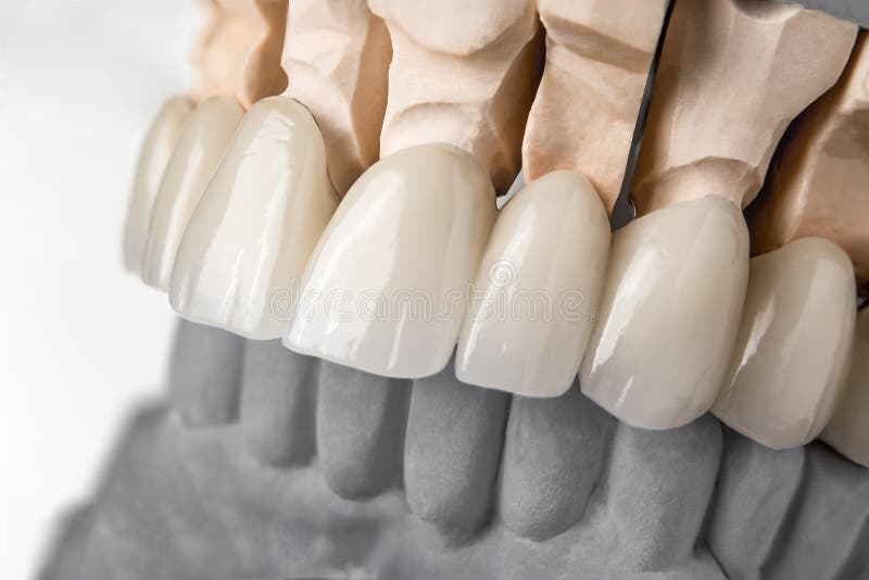 Row of teeth prosthesis stock image. Image of false, mold - 85857513
