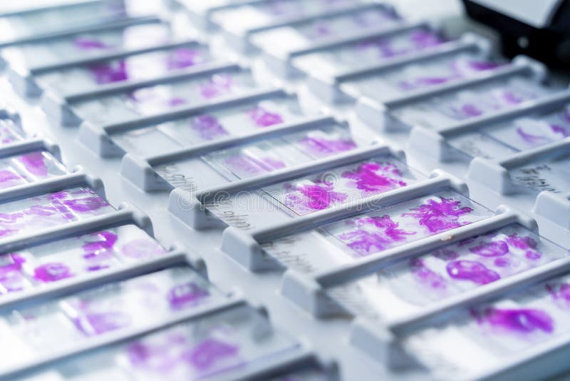 Rows of Microscope Glass Slide in the Cells Stock Photo - Image of ...