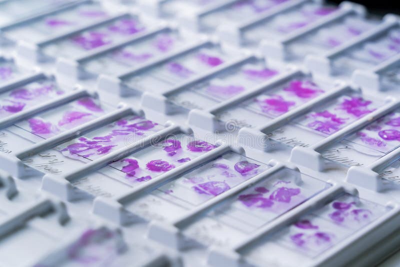 Rows of Microscope Glass Slide in the Cells Stock Image - Image of ...