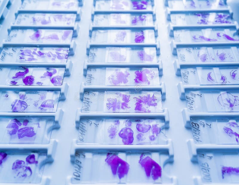 Rows of Microscope Glass Slide in the Cells Stock Photo - Image of ...