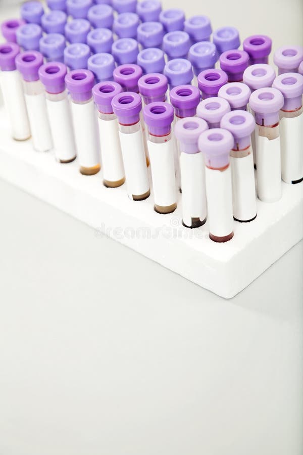 Rows of Test Tubes stock image. Image of professional - 46464009