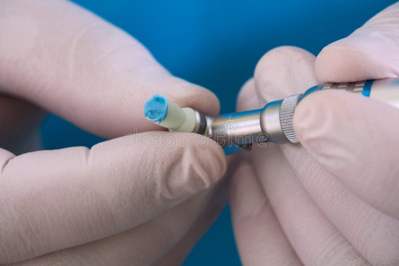 Rubber Cup for Polishing and Cleaning Natural Teeth. Dental Rubber Cup ...