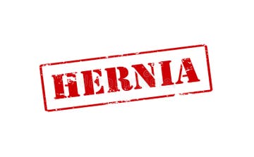 Hernia Symbol Stock Illustrations – 226 Hernia Symbol Stock ...
