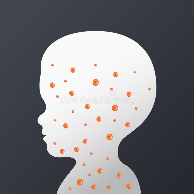 Rubella Stock Illustrations – 415 Rubella Stock Illustrations, Vectors ...