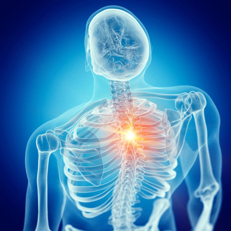 Rugpijn stock illustratie. Illustration of ruggegraat - 127831653